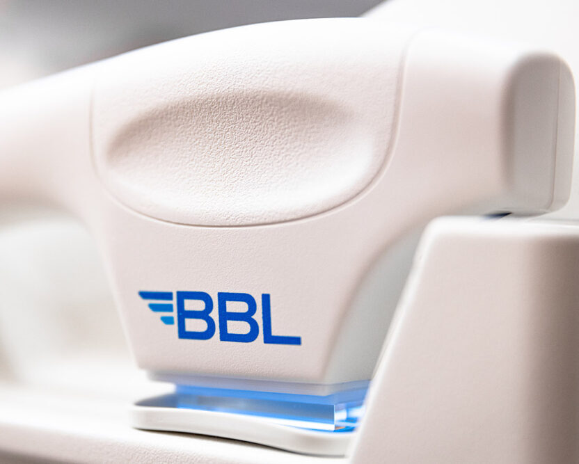 BBL Laser Photofacial Cincinnati | Correct Sun Damage Fast