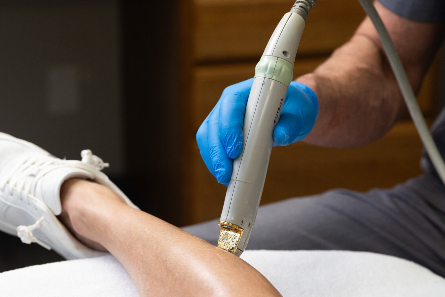 Laser Vein Removal Cincinnati | Treat Spider Veins Instantly