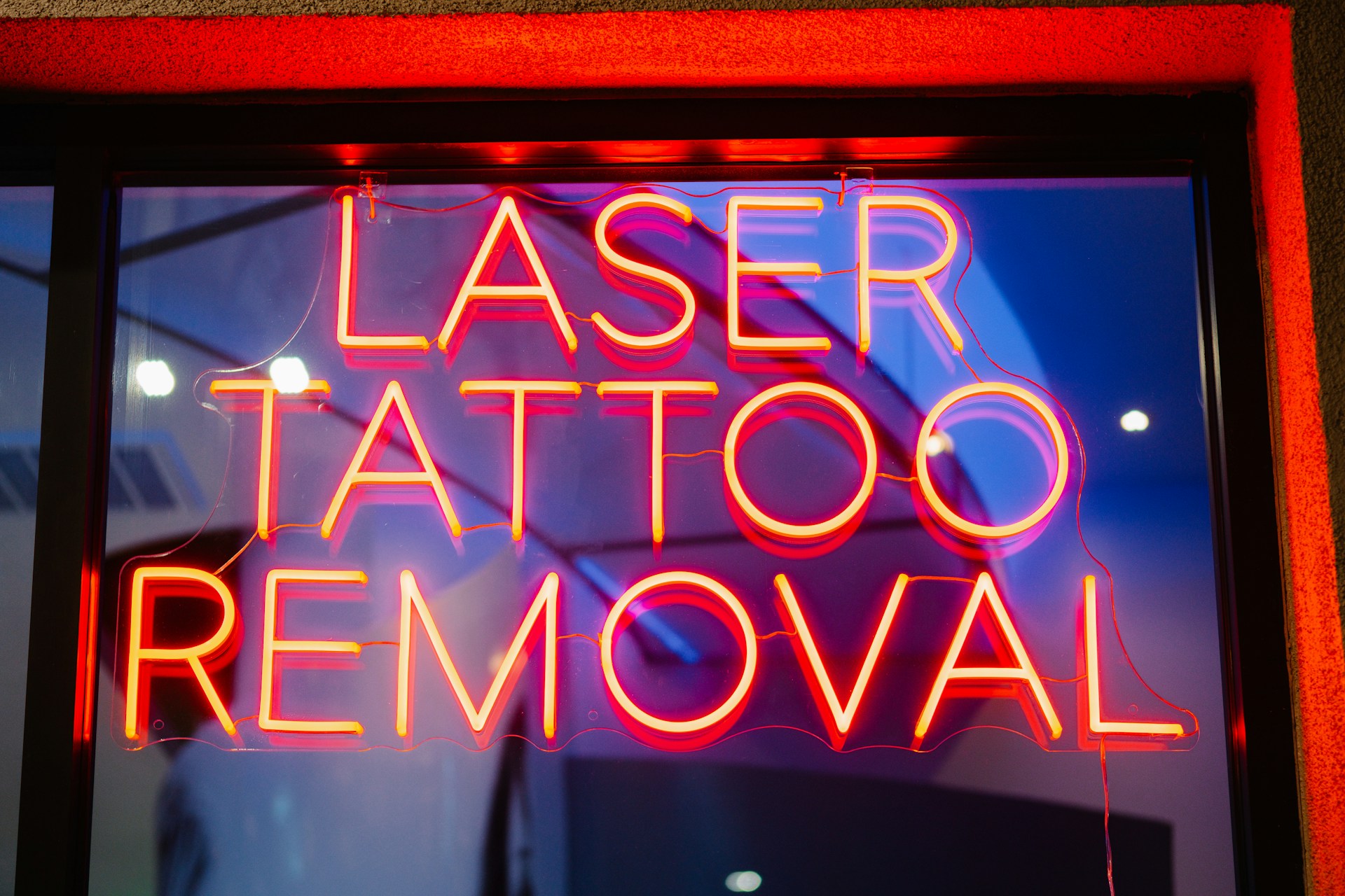 Laser Tattoo Removal in Cincinnati Without Damaging Skin Barrier
